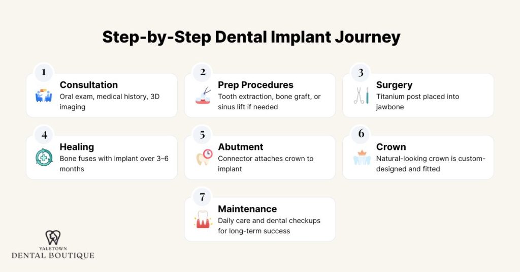 Dental Implants Procedure | From Consultation to Crown